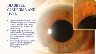 Diabetes & The Eye Dr MOHAMMAD MOMANI PAPER PRESENTATION.pptx