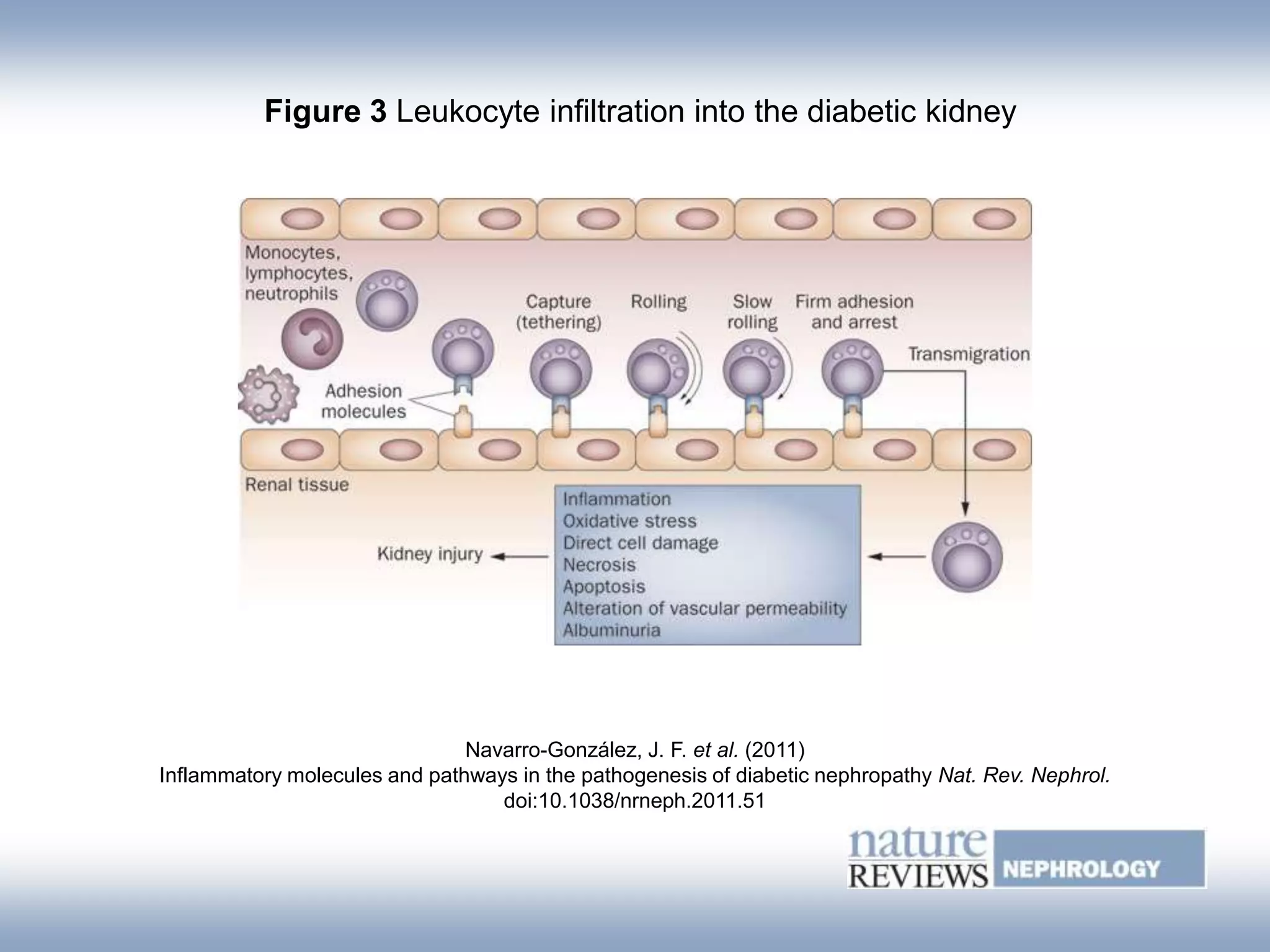 Diabetic nephropathy | PPT
