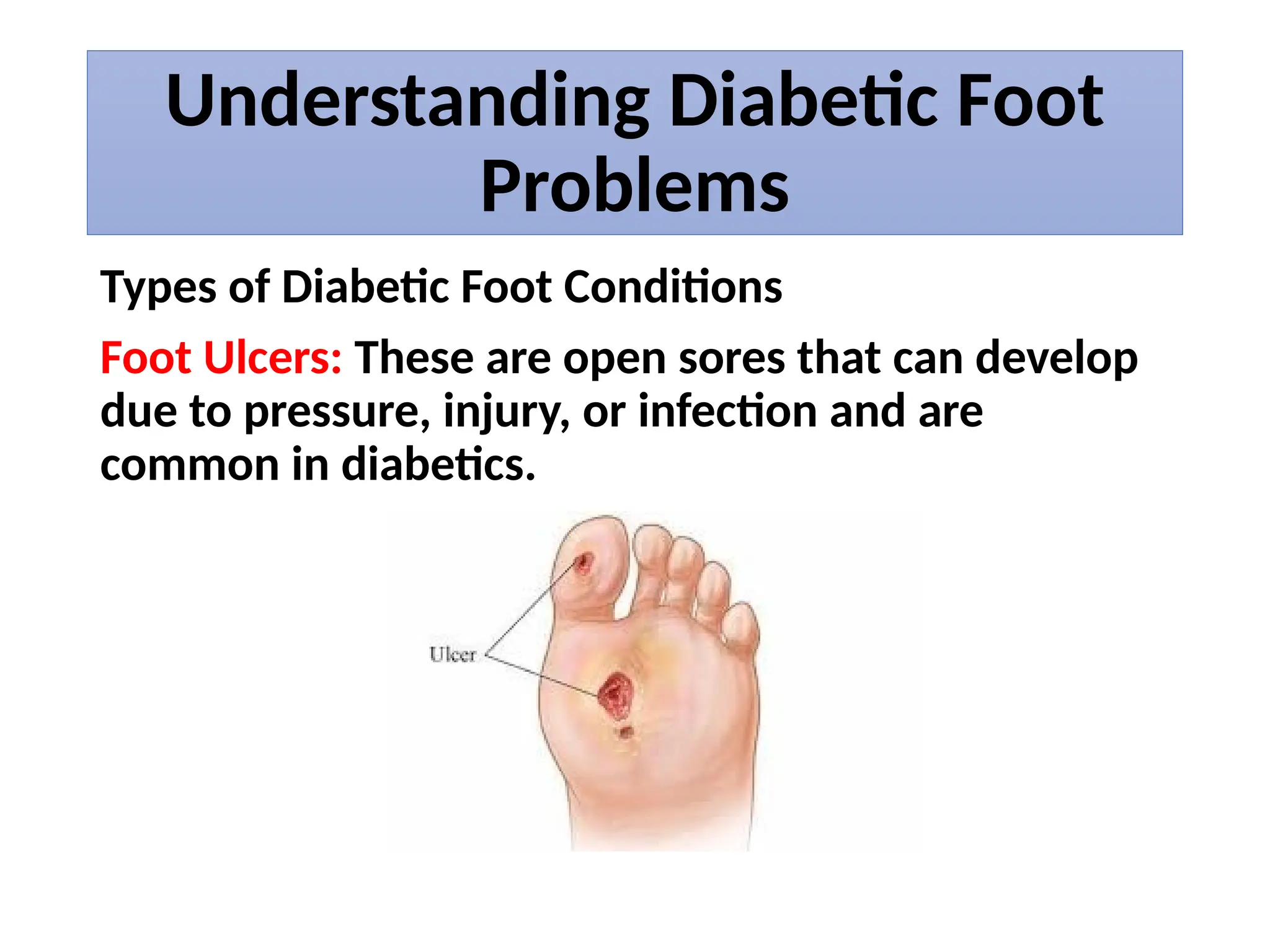 Synopsis of management of diabetic-foot--ppt.pptx