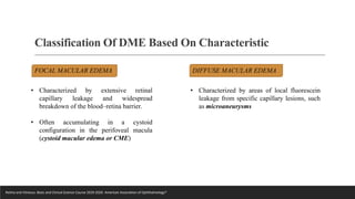 Diabetic-Macular-Edema-.rova-virgana.pptx