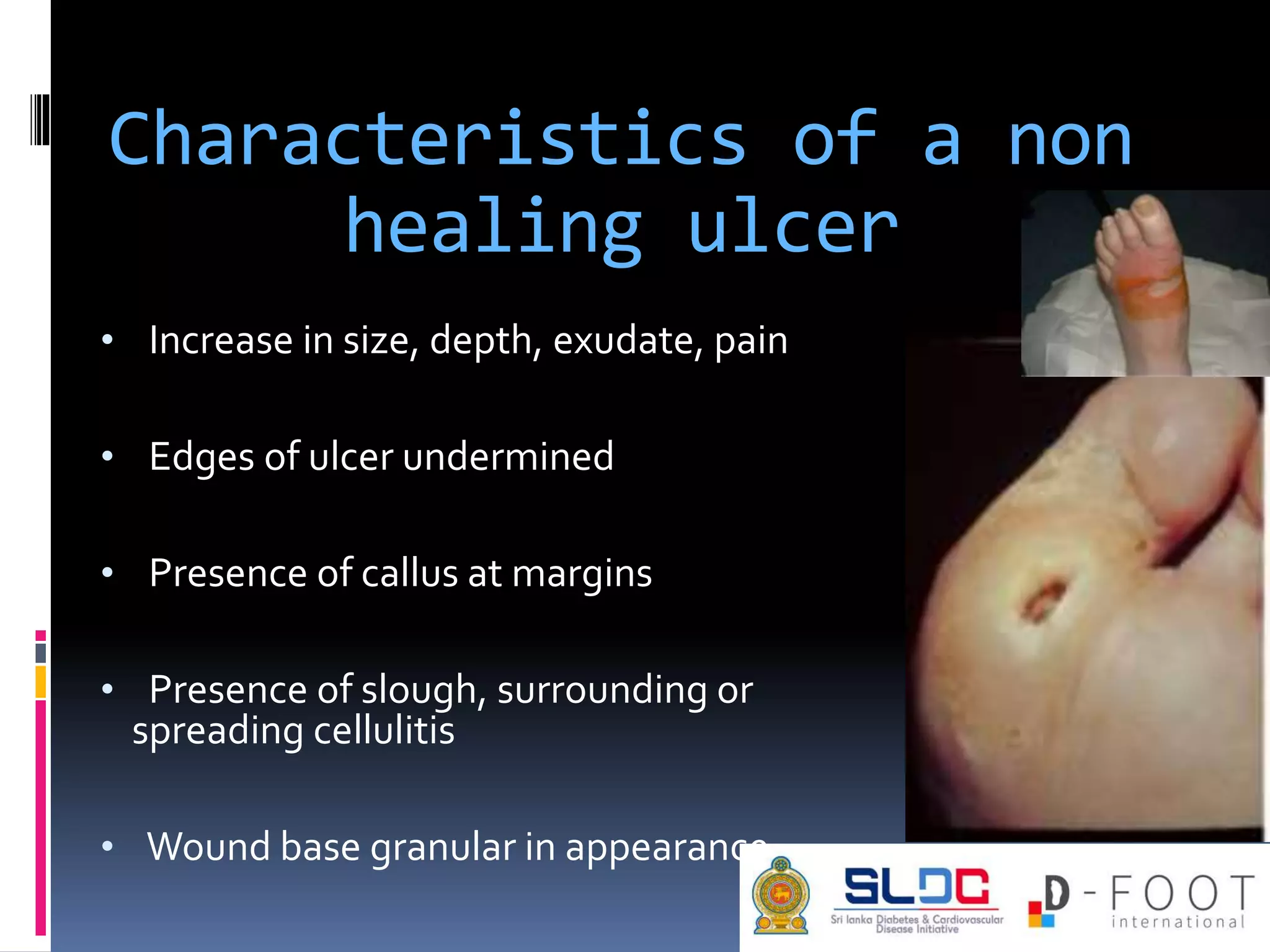 Basic Wound Care Treatment principals for simple ulcers Diabetic 2019 | PPT