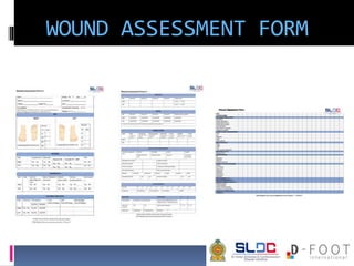 Basic Wound Care Treatment principals for simple ulcers Diabetic 2019 | PPT