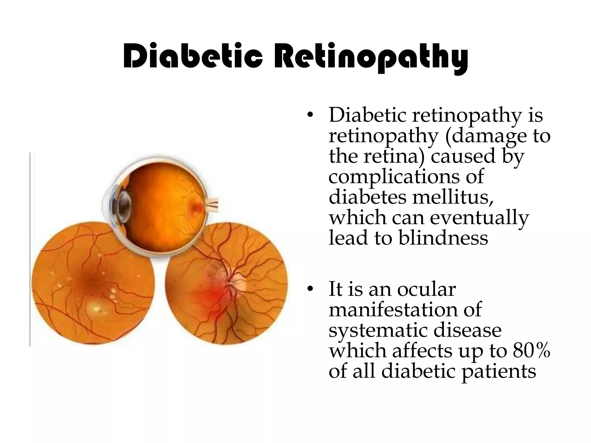 Diabetic and hypertensive retinopathy | PPTX