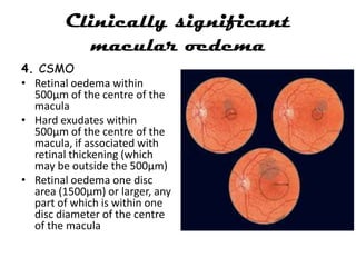 Diabetic and hypertensive retinopathy | PPTX