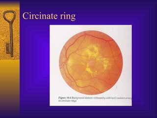 Diabetic disease[1] | PPT