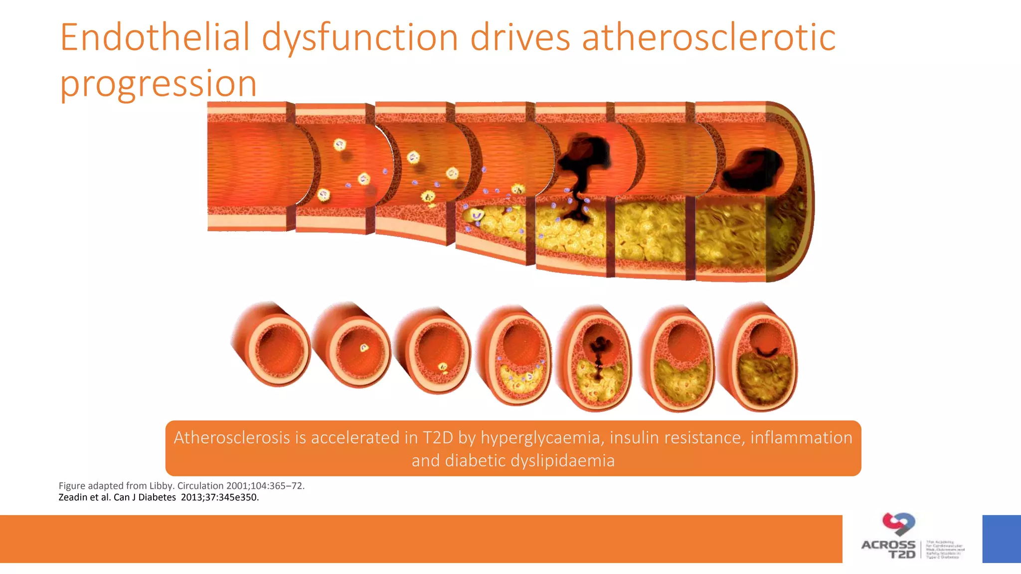 Diabetic Dyslipidemia - A True CV risk | PPTX