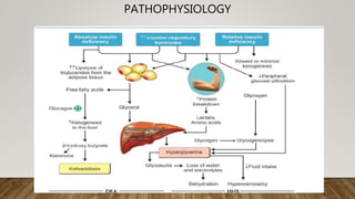 Hyperglycaemic emergencies | PPTX
