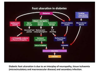 Diabetic Foot | PPT