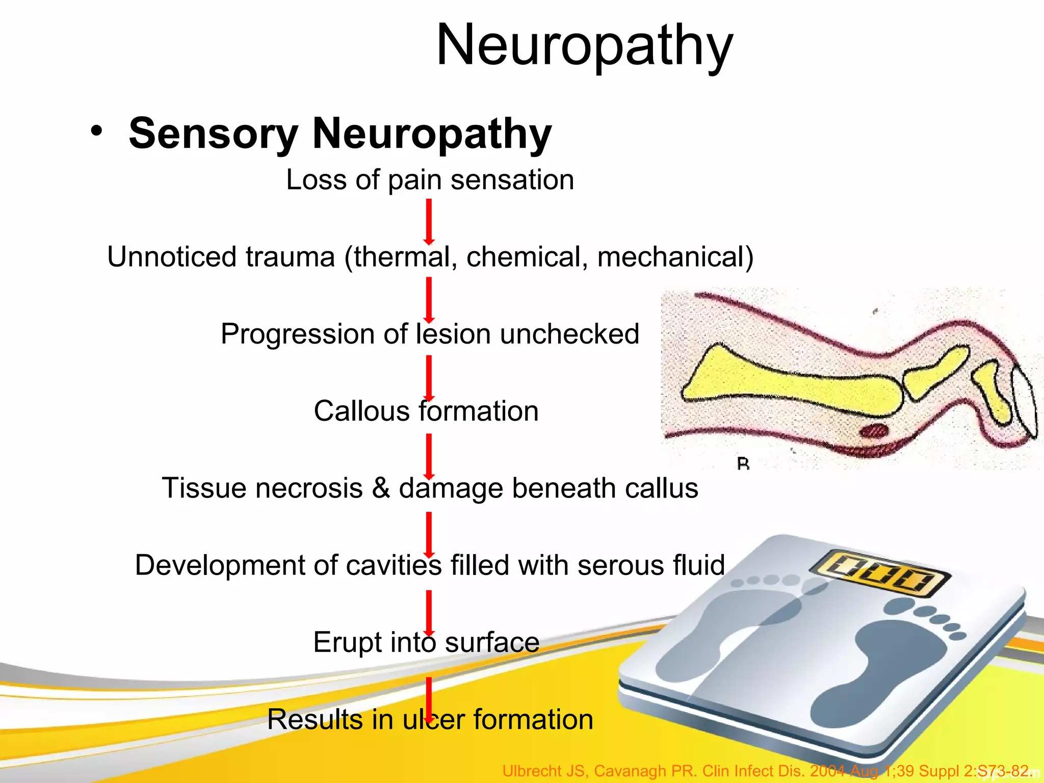 Diabetic foot | PPT