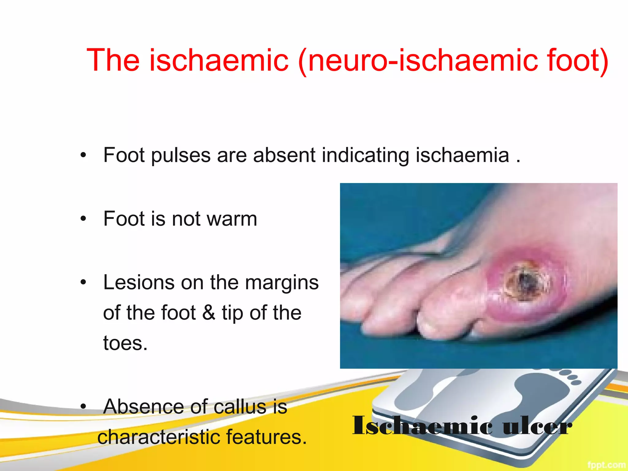Diabetic foot | PPT