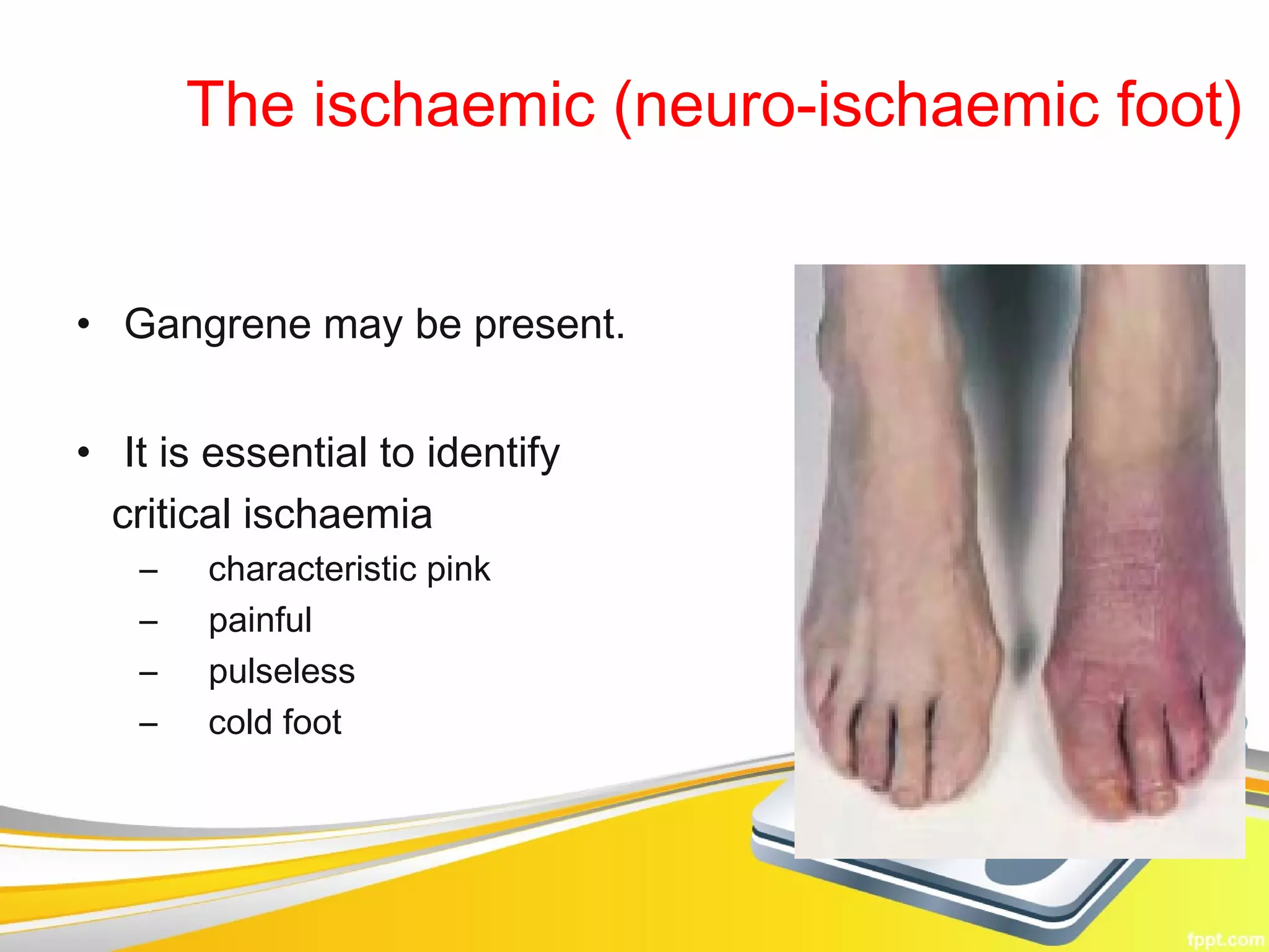 Diabetic foot | PPT