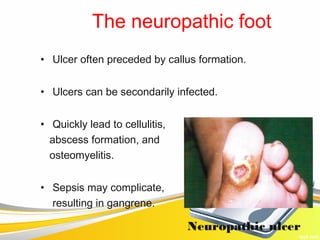 Neuropathic Ulcer