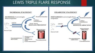 Diabetic foot | PPTX