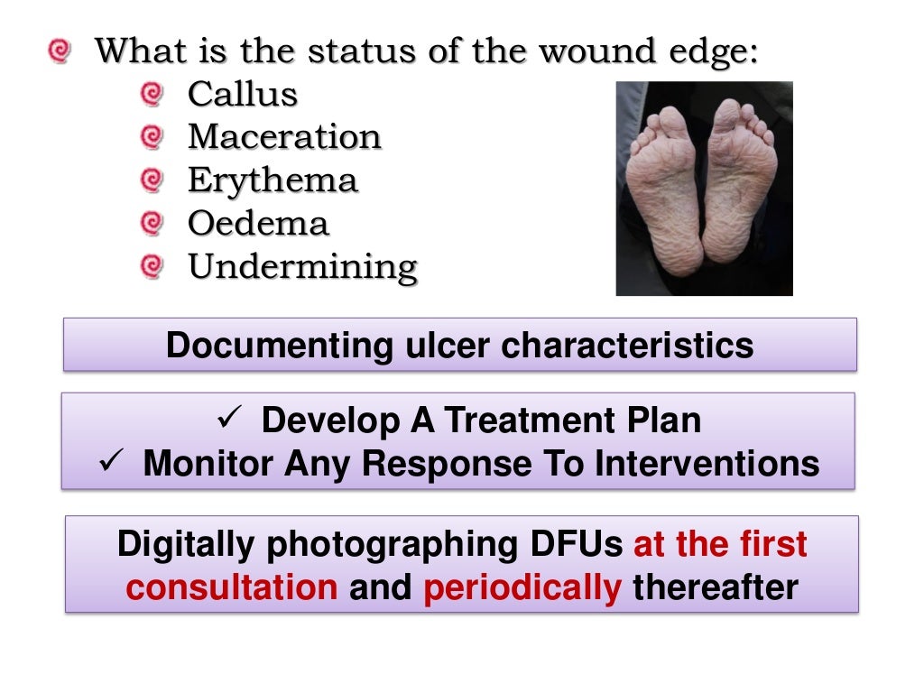 Diabetic Foot Management Overview | PDF