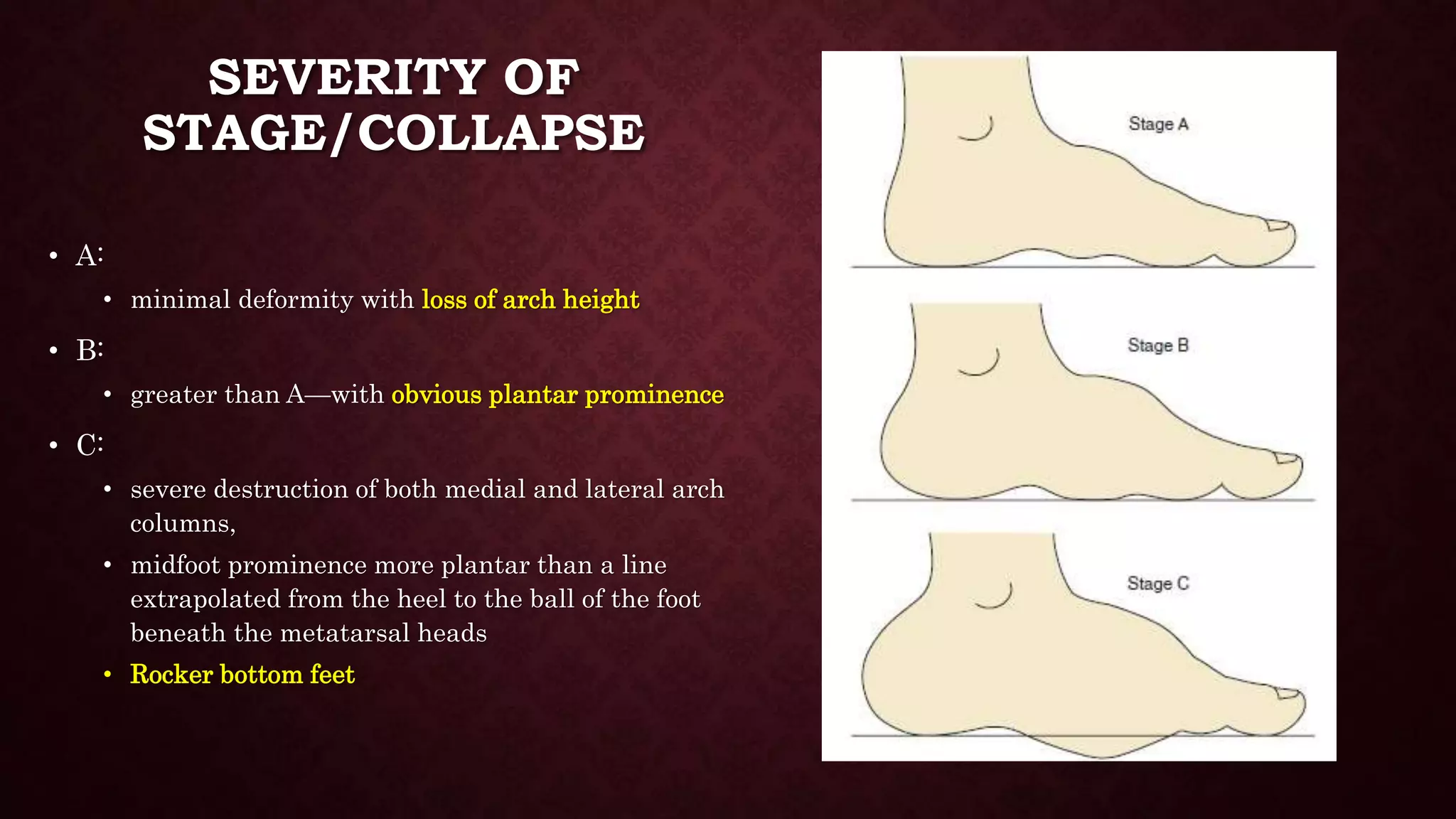 Diabetic foot | PPTX