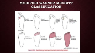 Diabetic foot | PPTX
