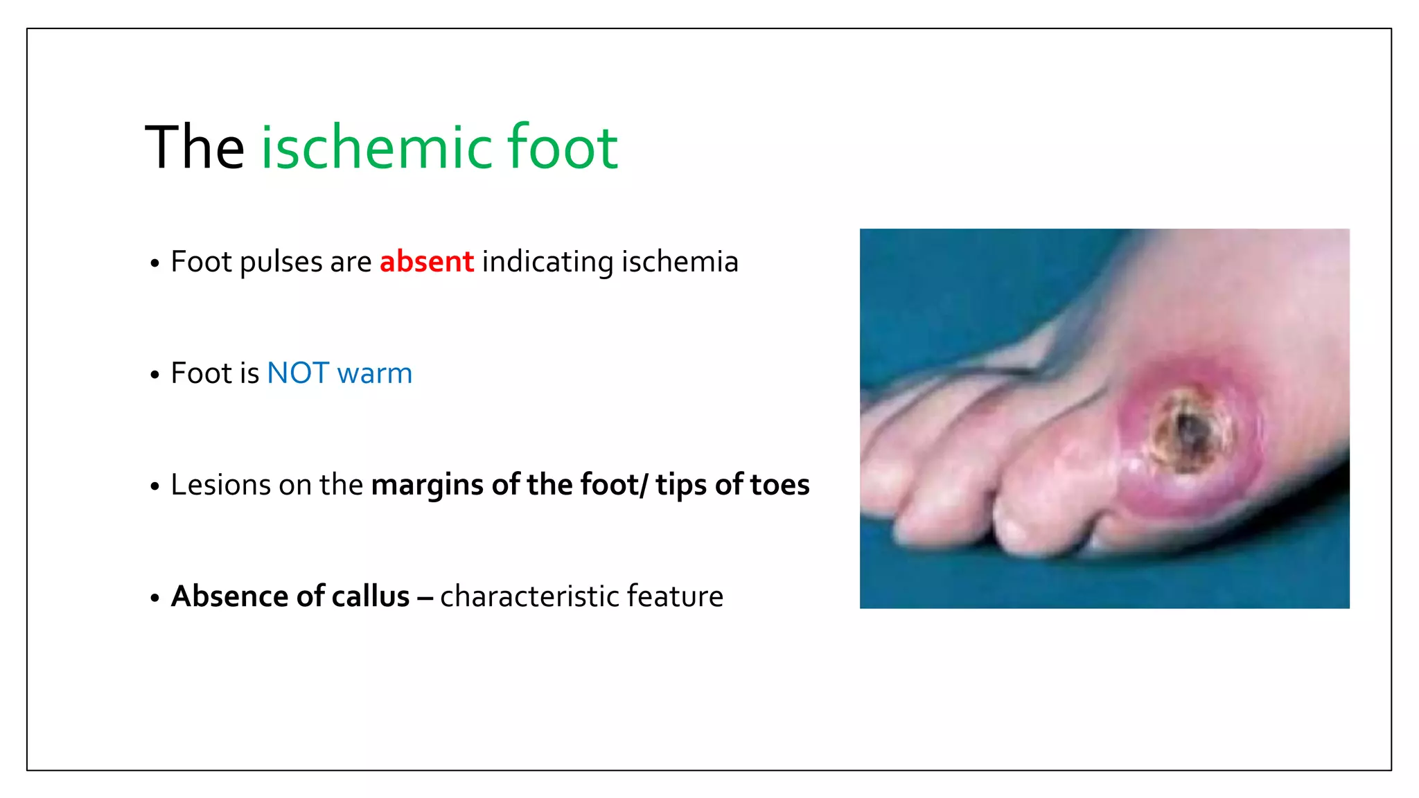 Diabetic foot.pptx