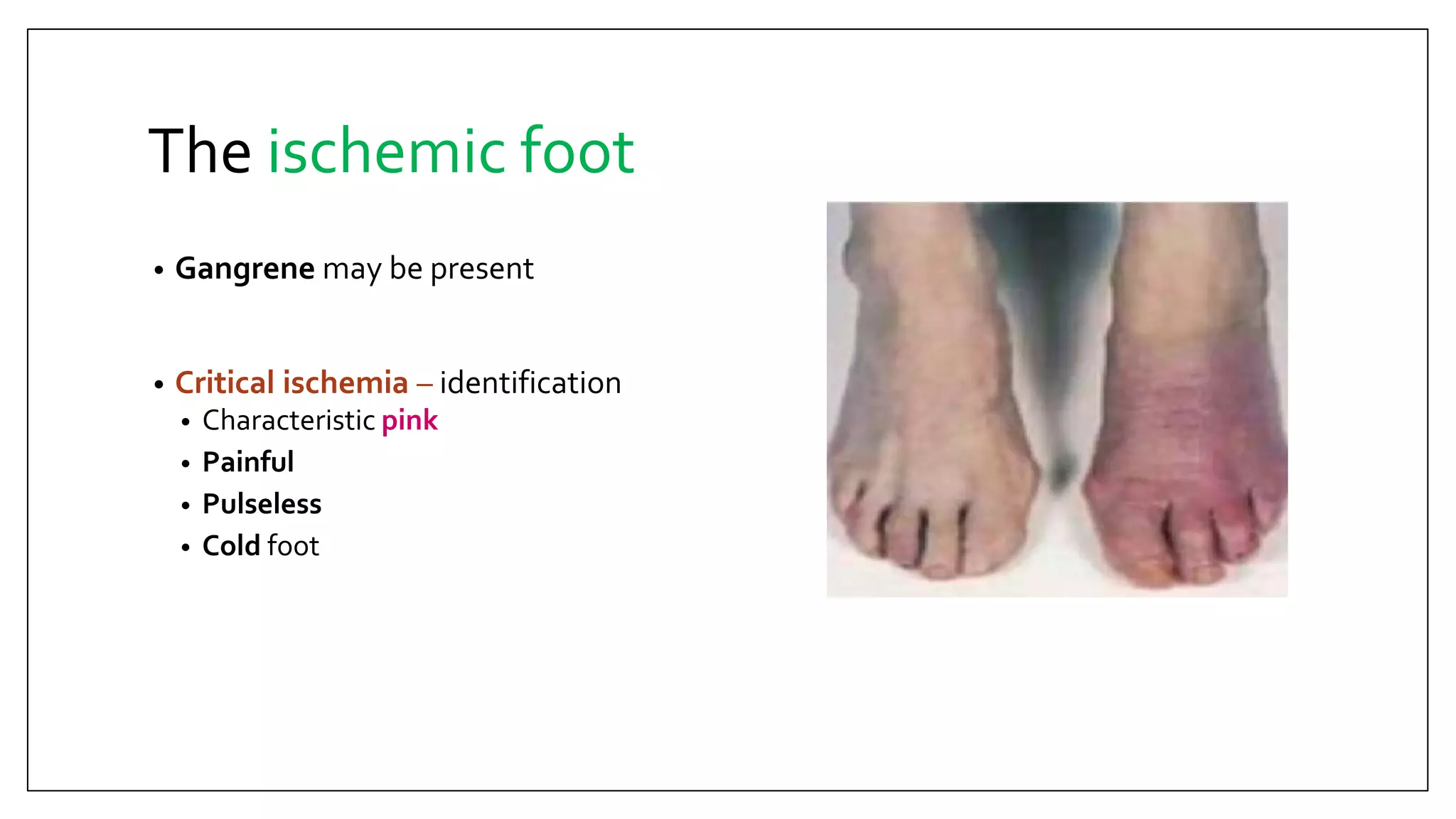 Diabetic foot.pptx