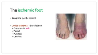 Diabetic foot.pptx