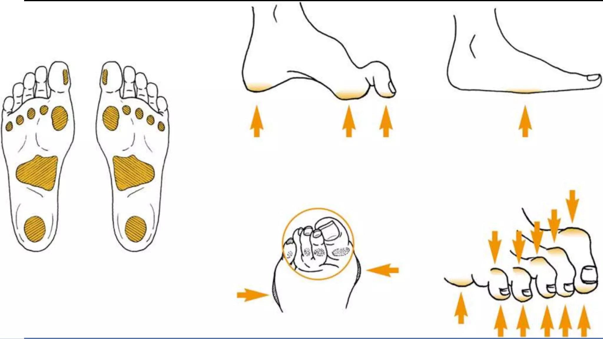 Diabetic foot and foot care.pptx