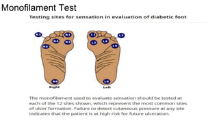 DIABETIC FOOT grading and management clinical | PPT