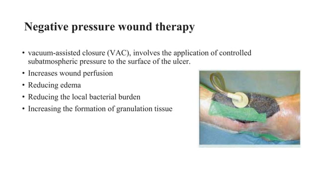 DIABETIC FOOT grading and management clinical | PPT