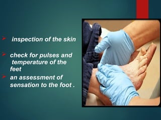 DIABETIC FOOT.pptxjeenebwnnsnsnwnnwnsnsmw | PPTX