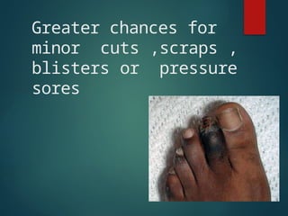DIABETIC FOOT.pptxjeenebwnnsnsnwnnwnsnsmw | PPTX