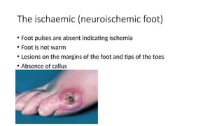 DIABETIC FOOT. Anatomy, physiology, risk factors and management | PPTX