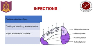 diabetic foot - Copy(1).pdf. Introduction , management of diabetic foot ...