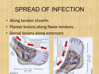 Diabetic Foot 1 - Intro, foot anat & Pathophysio.pptx