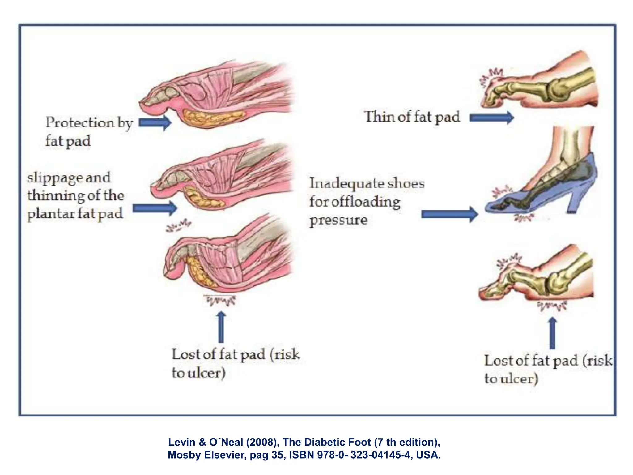 Diabetic Foot slide show vascular surgery | PPTX