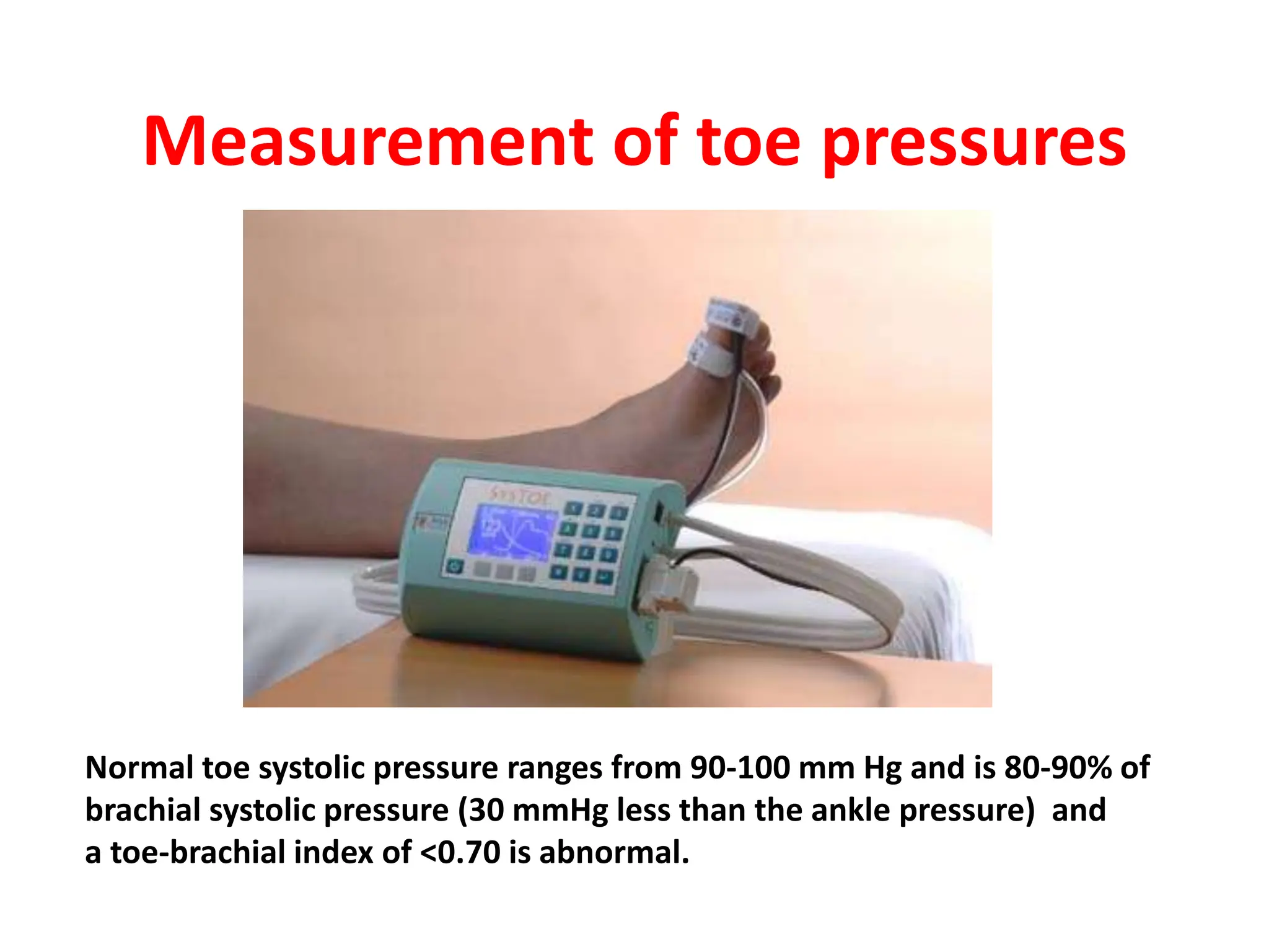 Diabetic Foot slide show vascular surgery | PPTX