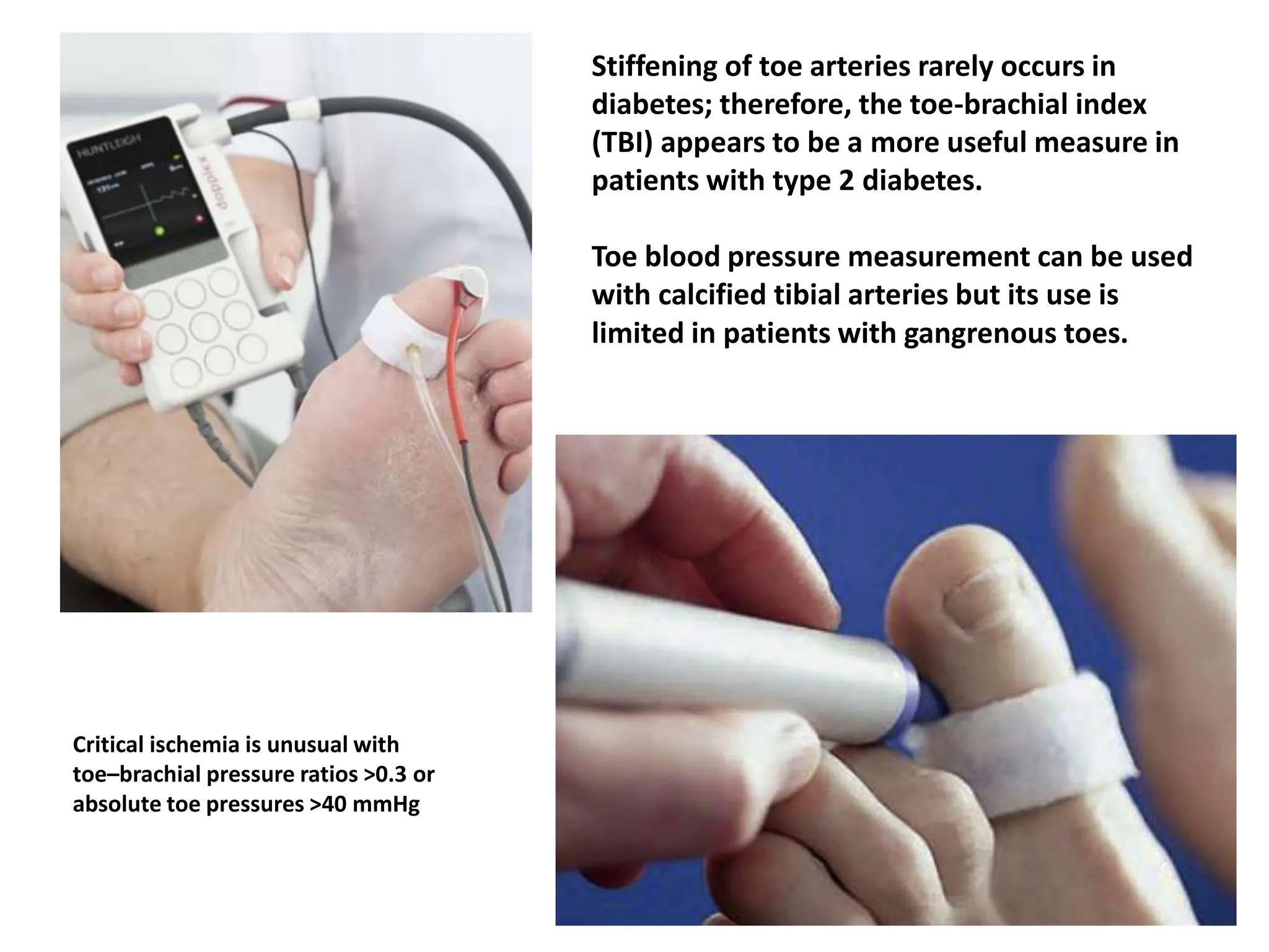 Diabetic Foot slide show vascular surgery | PPTX