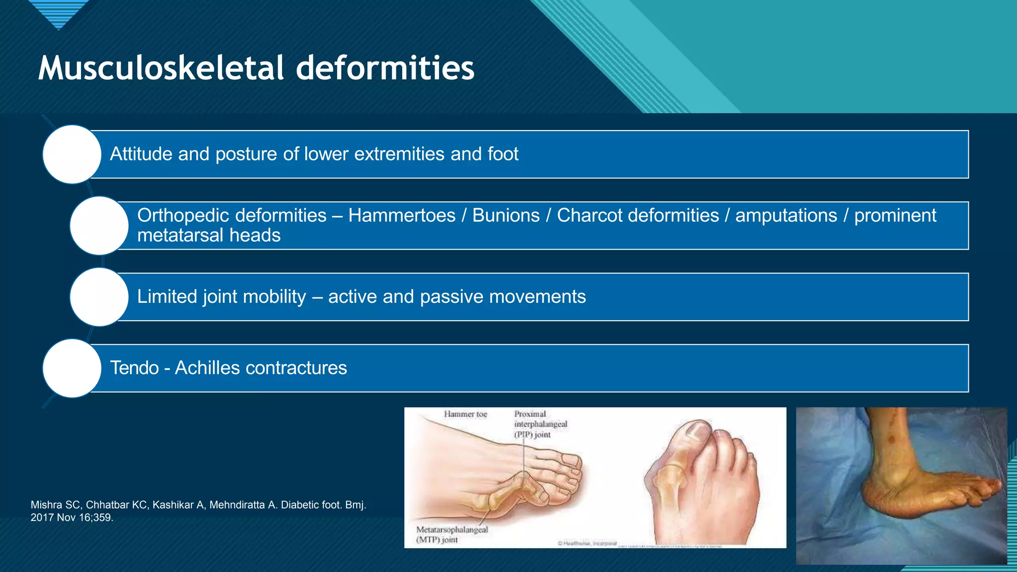 Diabetic foot and its complications -final.pptx