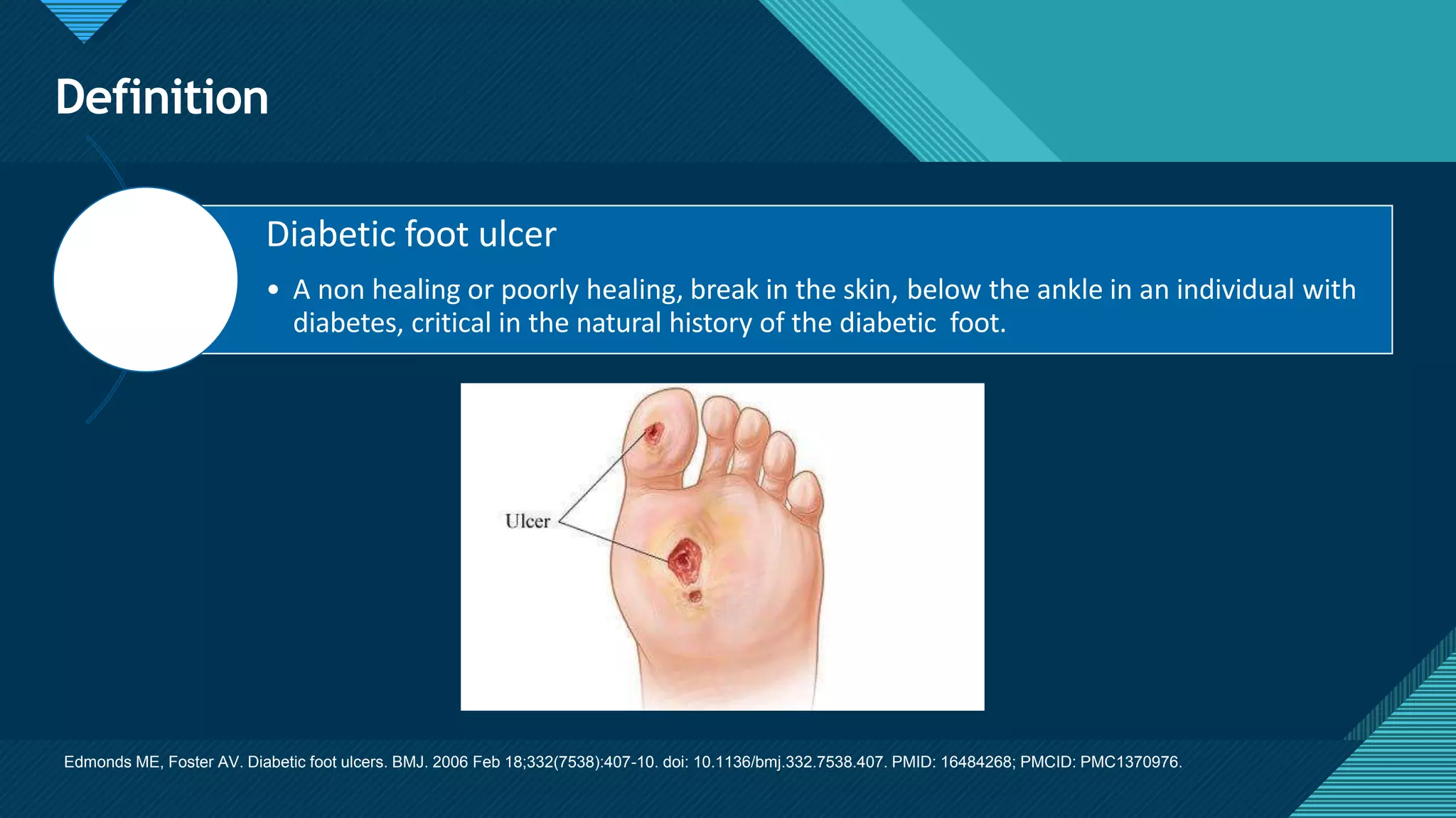 Diabetic foot and its complications -final.pptx