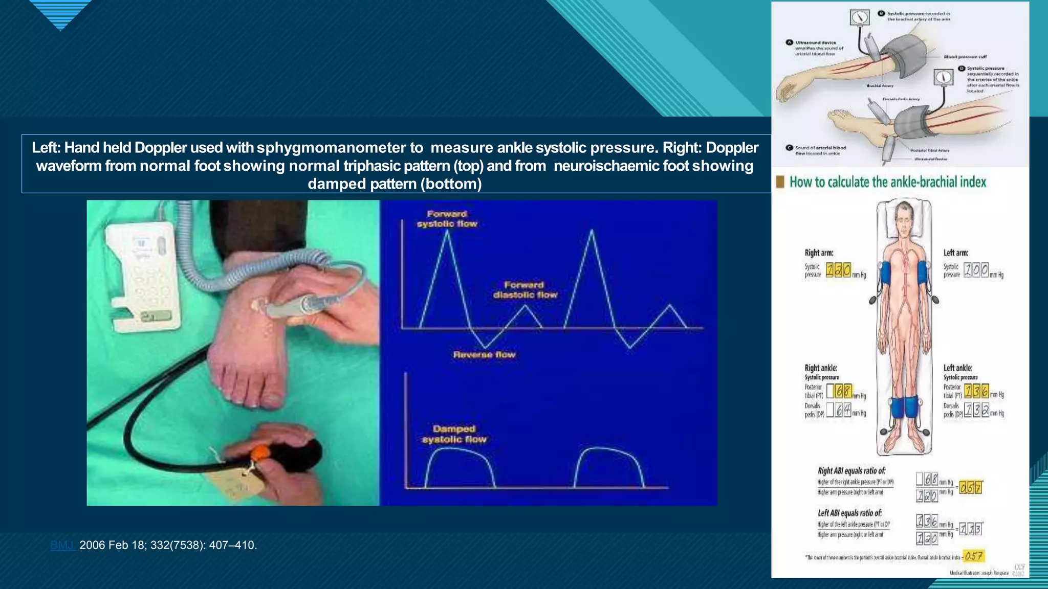 Diabetic foot and its complications -final.pptx