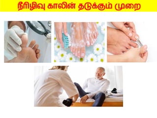 DIABETIC FOOT CARE HEALTH EDUCATION IN TAMIL LANGUAGE | PDF