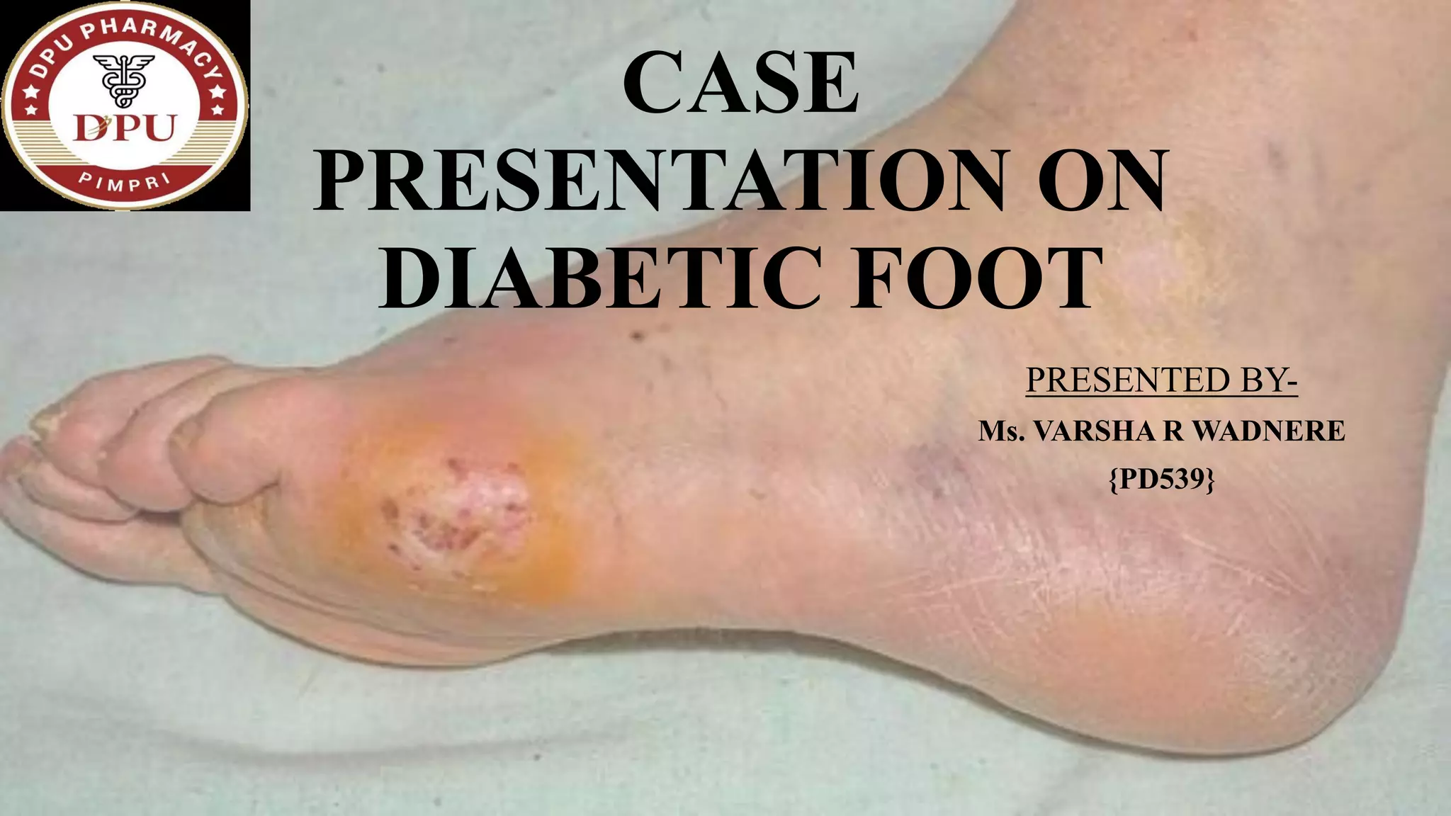 DIABETIC FOOT CASE PRESENTATION.pdf