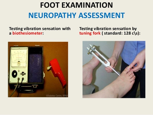 Diabetic foot disease