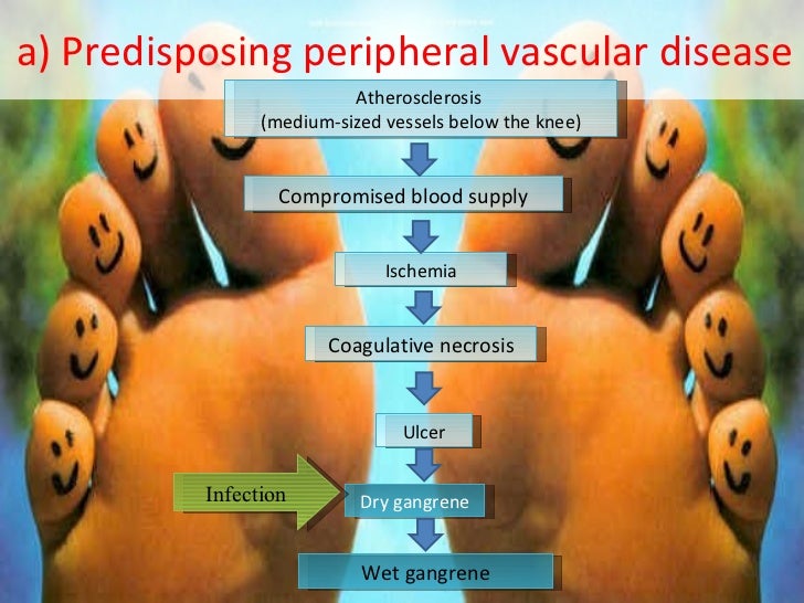 Diabetic Foot Ulcer Gangrene at Andre Thompson blog