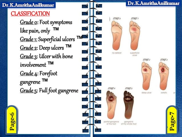 Diabetic foot& Gangrene by Dr.AmrithaAnilkumar | PPTX