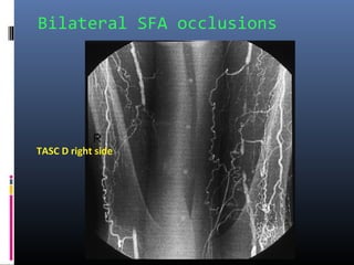 Diabetic Foot Interventions | PPT