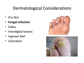 Diabetic foot lecture 2010 | PPT