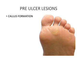DIABETIC FOOT - INVESTIGATIONS AND CLINICAL FEATURES | PPT
