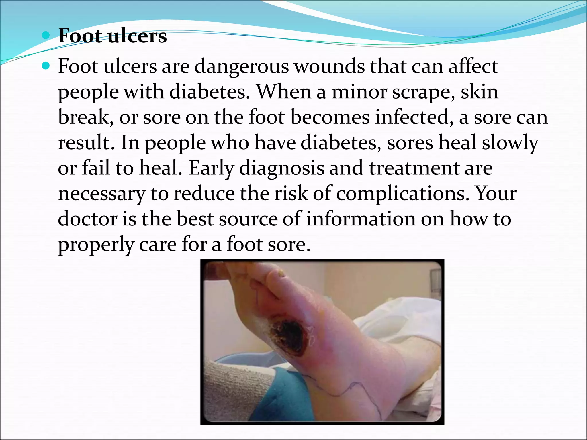 Diabetic foot power point | PPTX