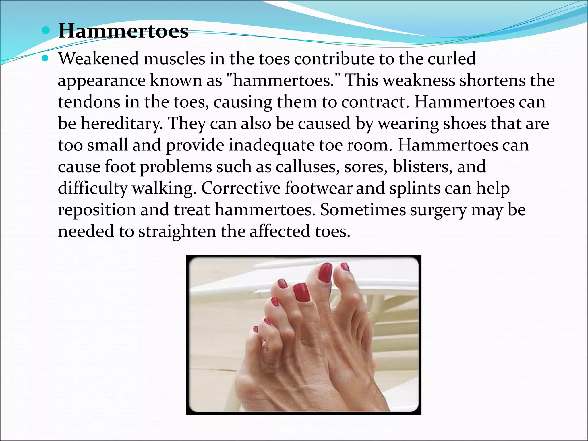 Diabetic foot power point | PPTX