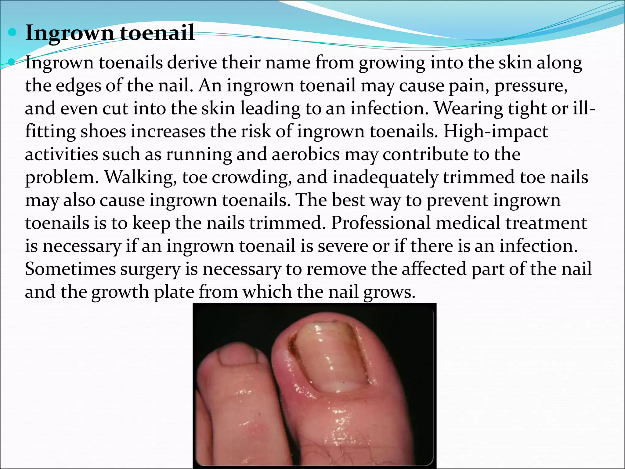 Diabetic foot power point | PPTX