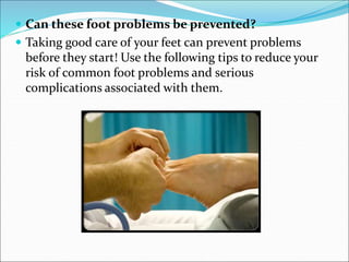 Diabetic foot power point | PPTX
