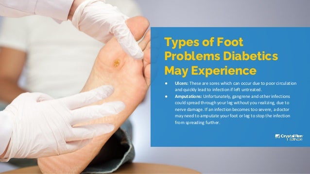Diabetic Foot Problems | PDF